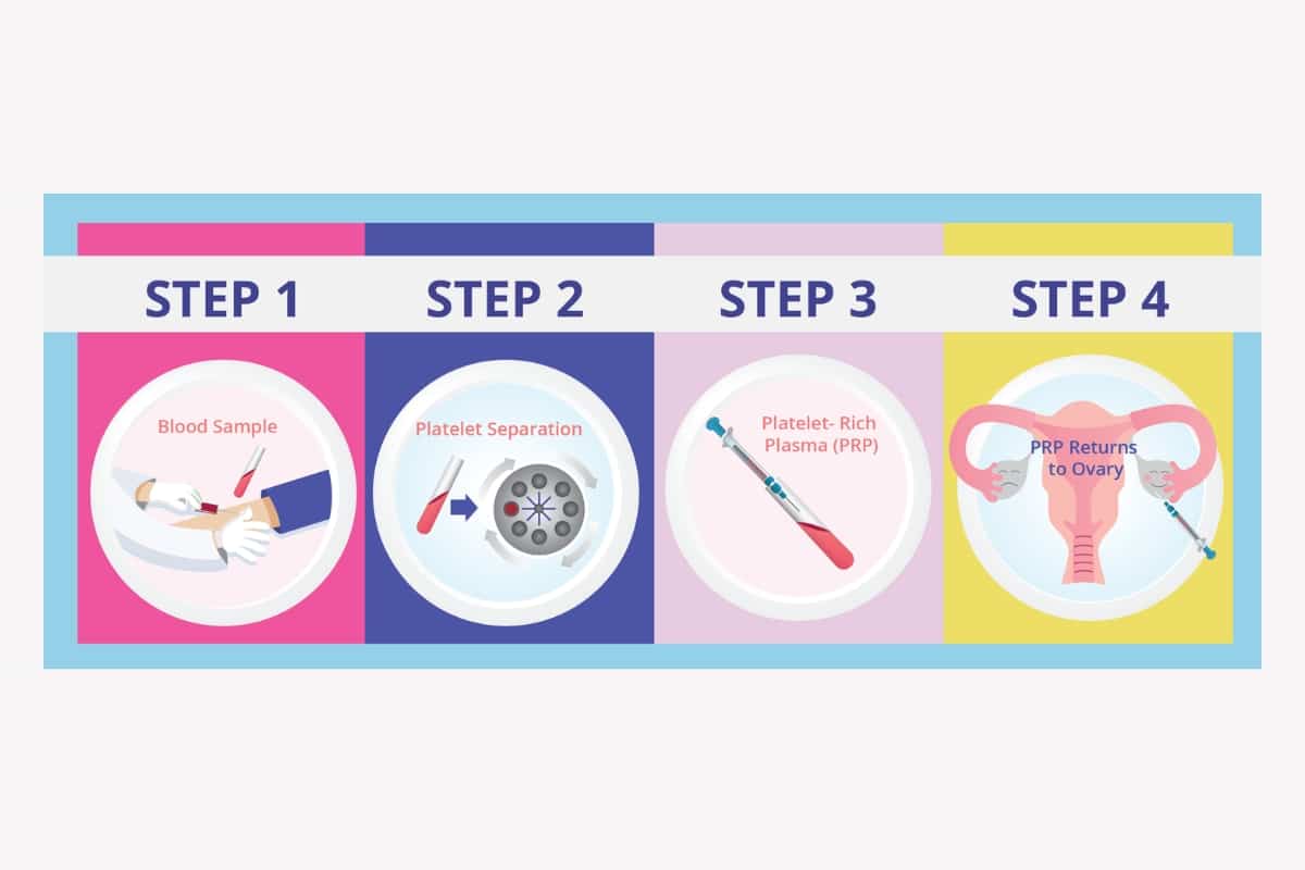 Αναζωογόνηση Ωοθηκών PRP Ovarian Rejuvenation Treatment PRP (Platelet ...